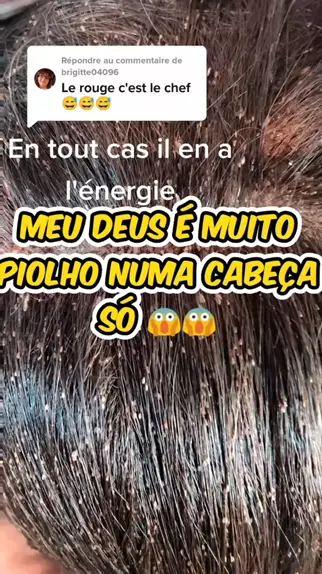 cabeca de escapole